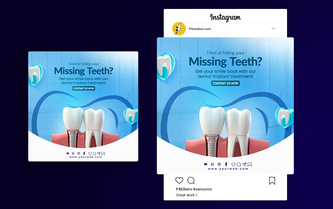 Missing Teeth Dental Implant Ad PSD Template – Pikstation